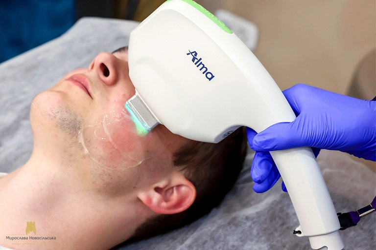 Laser removal of port-wine stains - Novosilska clinic